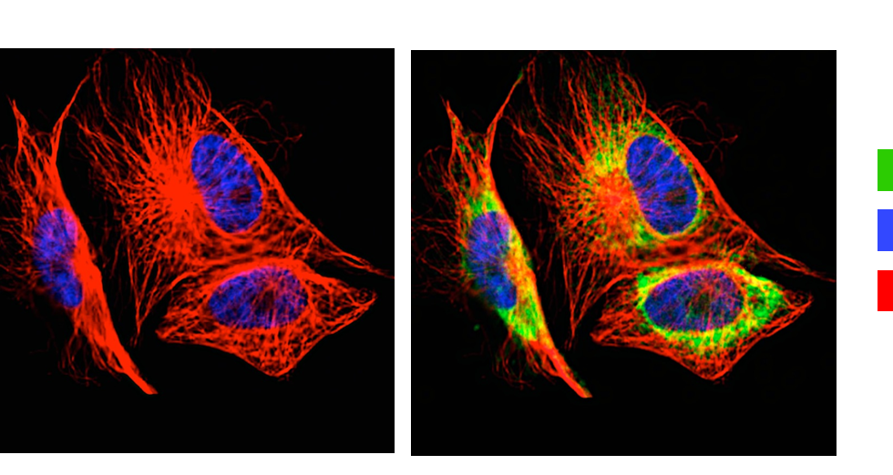 Role of endoplasmic reticulum stress in the progression and resistance ...